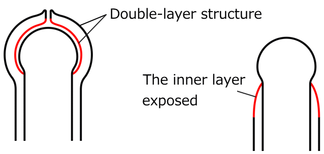 How to Cure Phimosis on Your Own